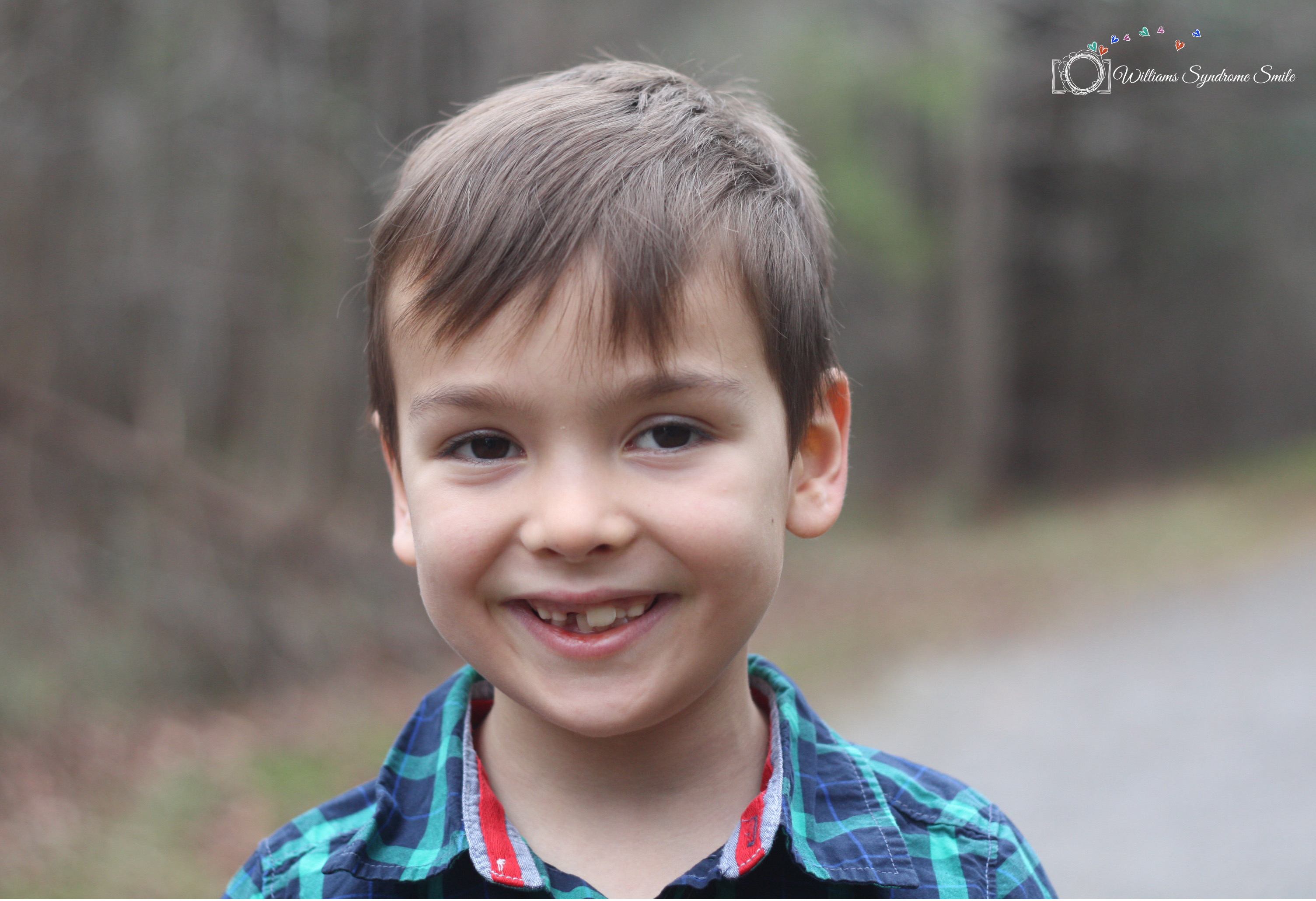 Theo | Williams Syndrome Smile